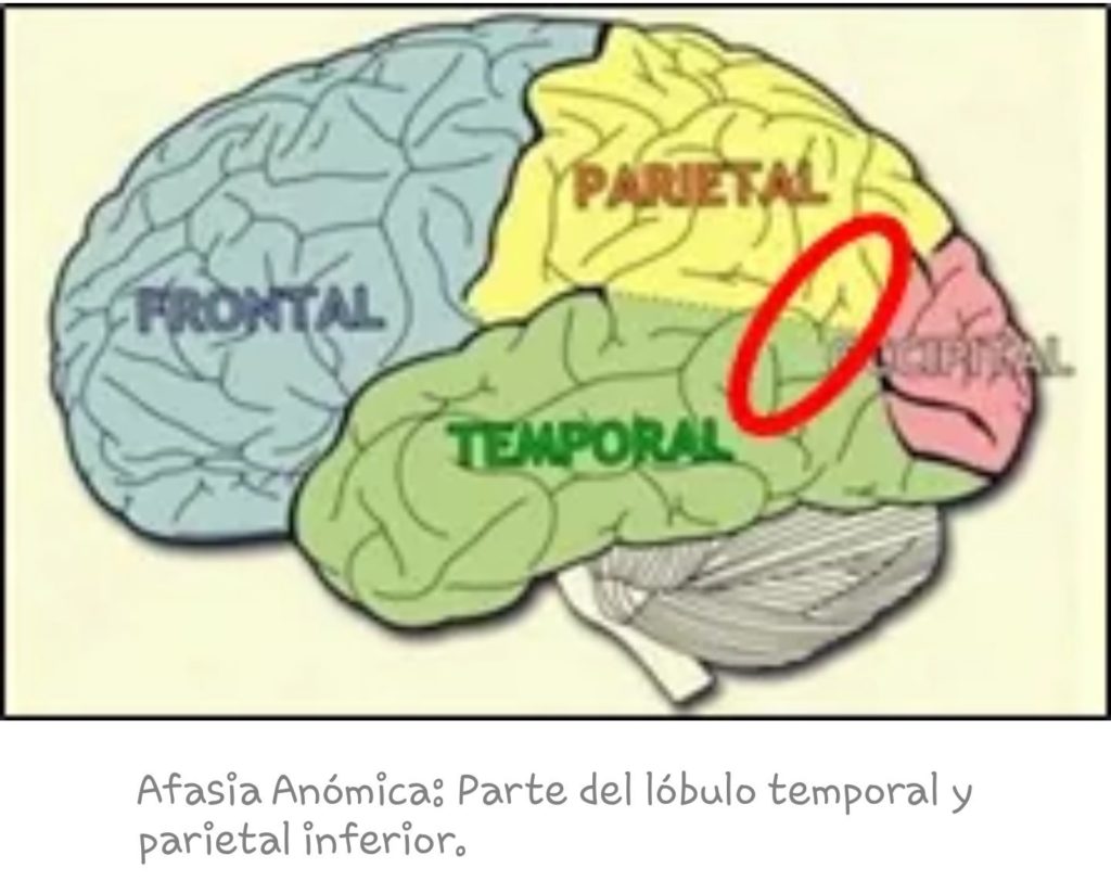 Afasia: Definición, tipos y características - NeuroClass