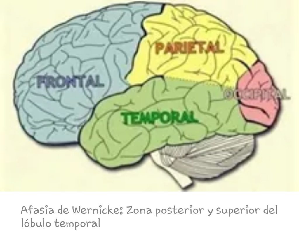 Afasia: Definición, tipos y características - NeuroClass