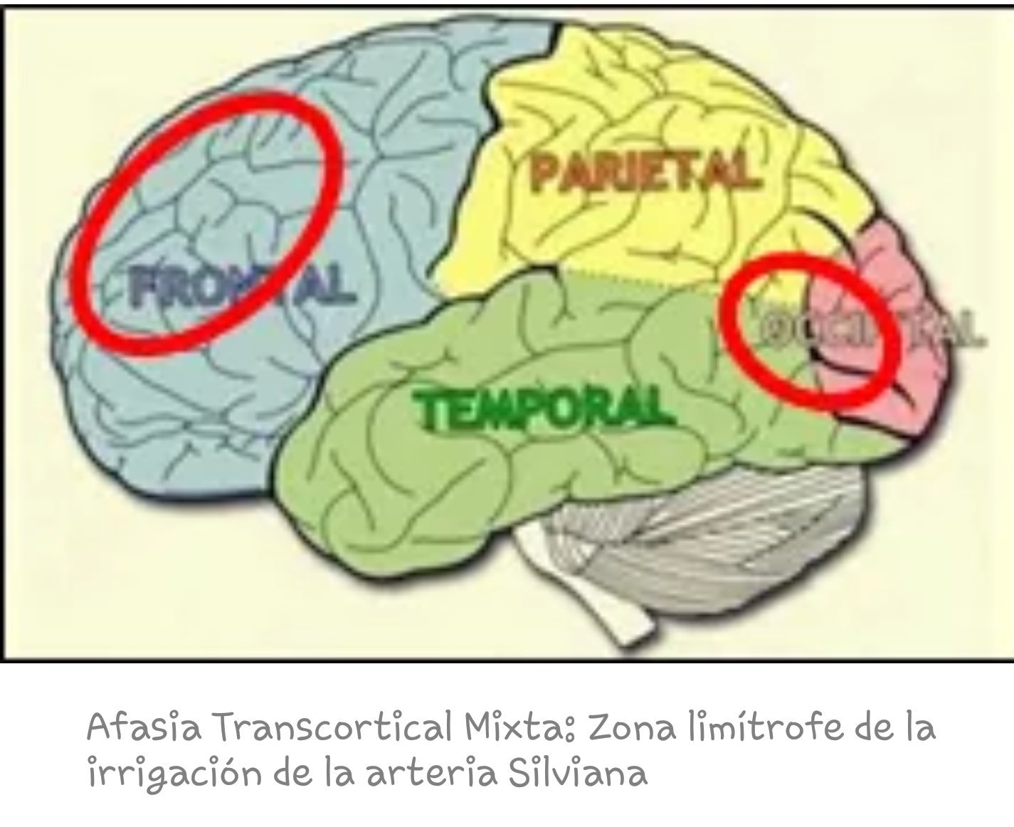 Afasia: Definición, tipos y características - NeuroClass